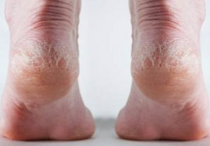 Our Fees – Peter Simson Podiatry